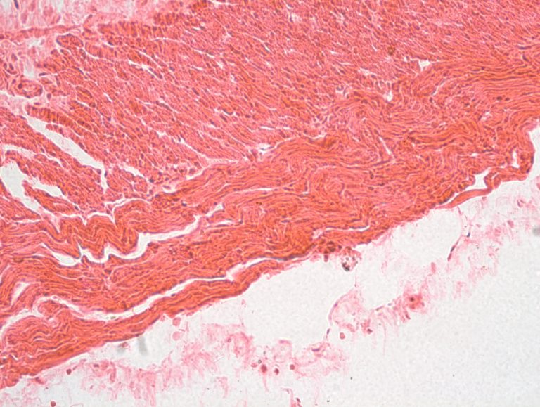 Esôfago | Atlas Virtual de Histologia